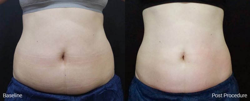 REFIT | CLUEDERM B2B