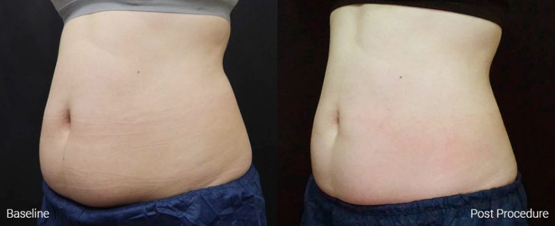 REFIT | CLUEDERM B2B