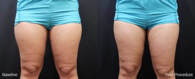 ULFIT | CLUEDERM B2B