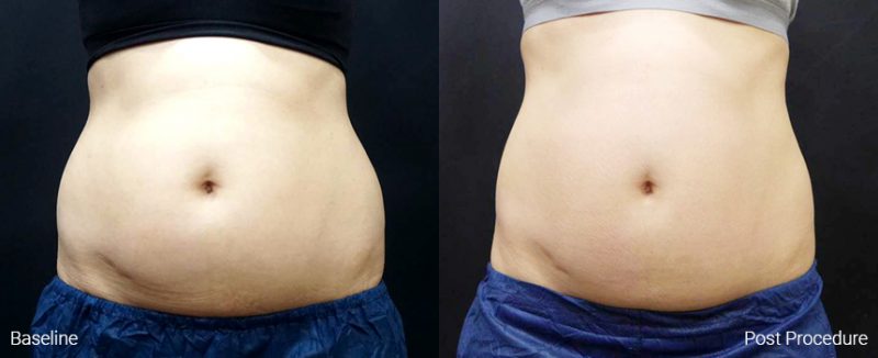 ULFIT | CLUEDERM B2B