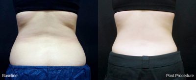 ULFIT | CLUEDERM B2B