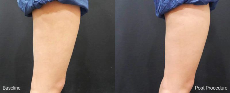 ULFIT | CLUEDERM B2B