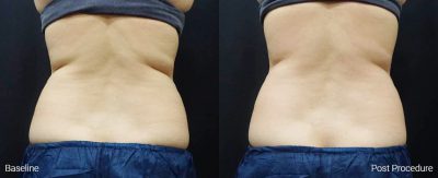 ULFIT | CLUEDERM B2B