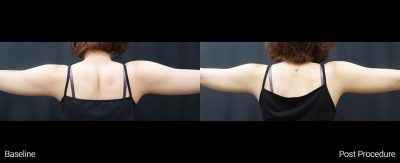 ULFIT | CLUEDERM B2B