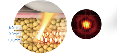 ULFIT | CLUEDERM B2B