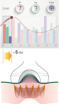 REFIT | CLUEDERM B2B