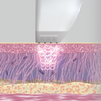 FORSHAPE | CLUEDERM B2B